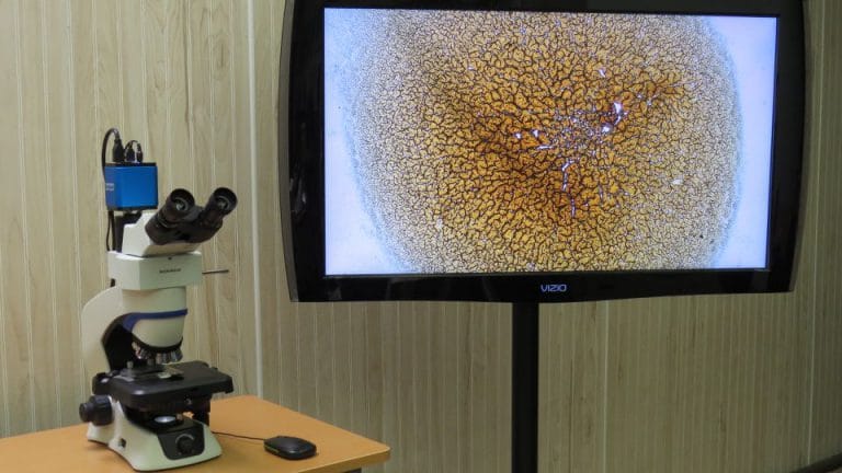 Best Live Blood Analysis and Darkfield Microscope Systems | Biomedx