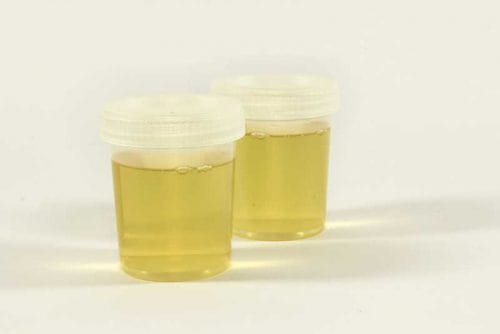 Urine Therapy